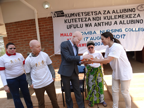 APAM calls for more support for People with albinism - The Maravi Post