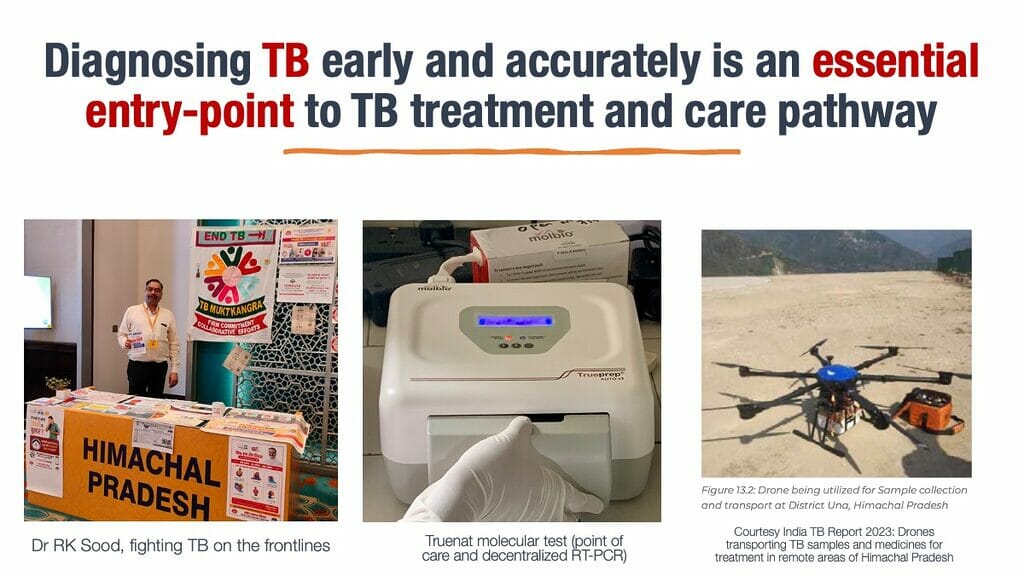 Early and accurate TB diagnosis is the gateway to #endTB pathway - The ...